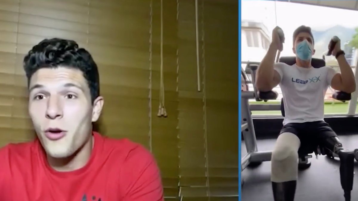 Modelo hispano llega al New York Fashion Week tras sufrir la amputación ...