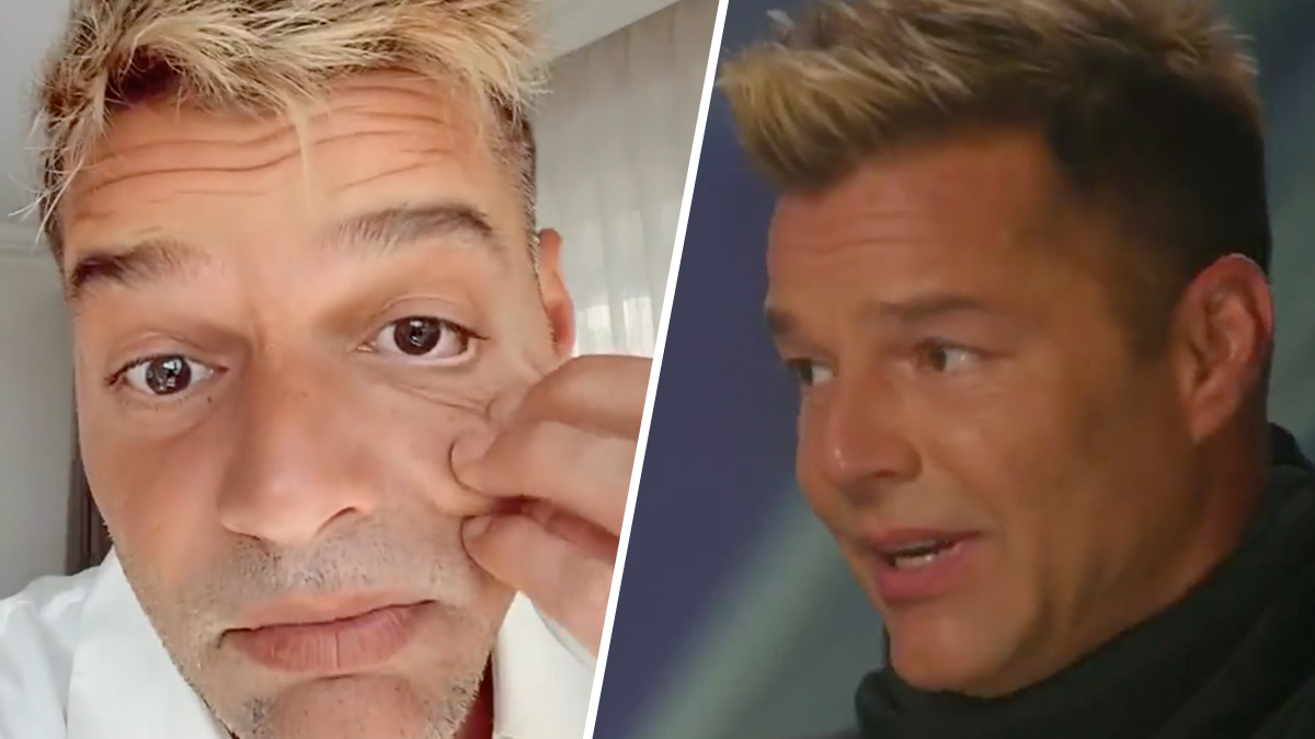 Ricky Martin niega haberse sometido a un procedimiento estético ...