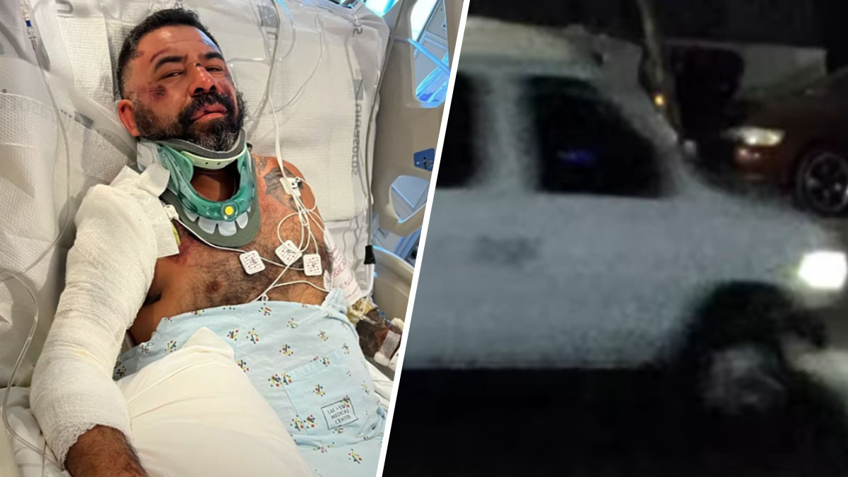 Conductor De Camioneta Atropella Y Arrastra A Un Hombre Tirado En La