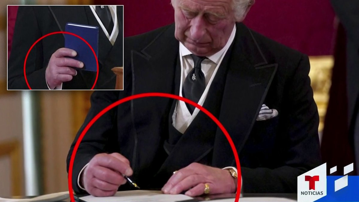 Video: las manos hinchadas y rojas del rey Carlos – Telemundo 52