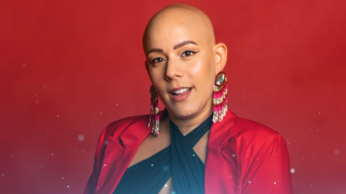Viviendo con alopecia: La historia de superación de Michelle Faraco ...