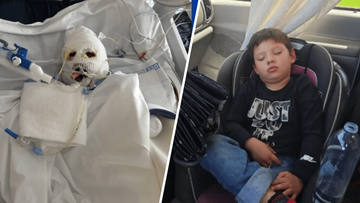 Niño de 5 años sobrevive a accidente en Rialto, California – Telemundo 52