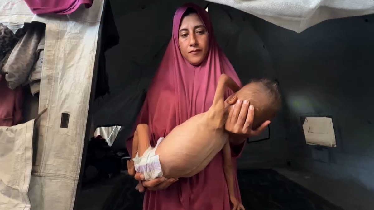 El calvario de una viuda con su bebé desnutrido en Gaza – Telemundo 52